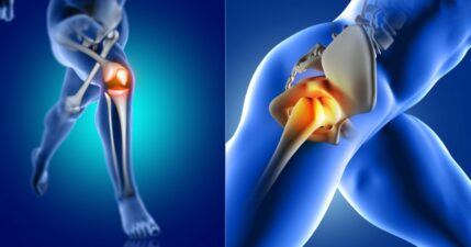 Best Orthopedic Surgeon for Knee and Hip Replacement in Bangalore ...